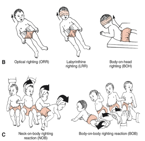 Optical Righting Reflex Infants